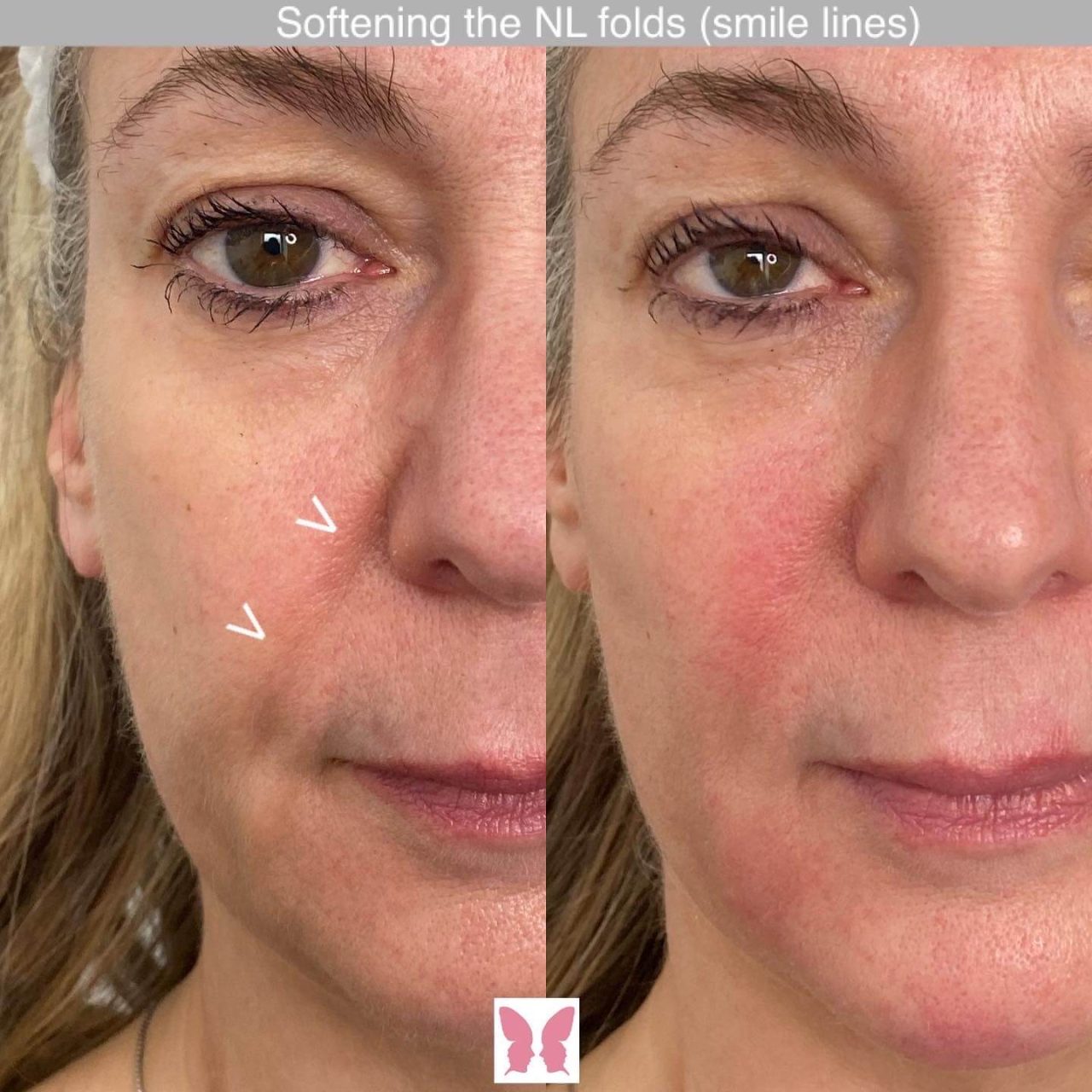 Gallery - DentalKind