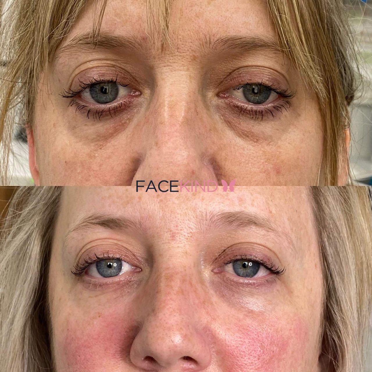 Gallery - DentalKind