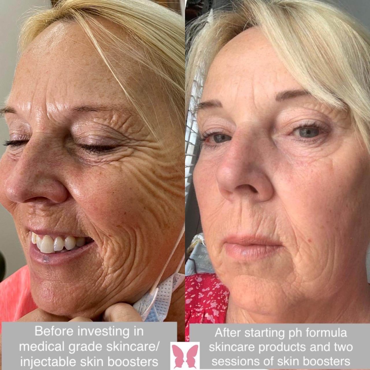 Gallery - DentalKind