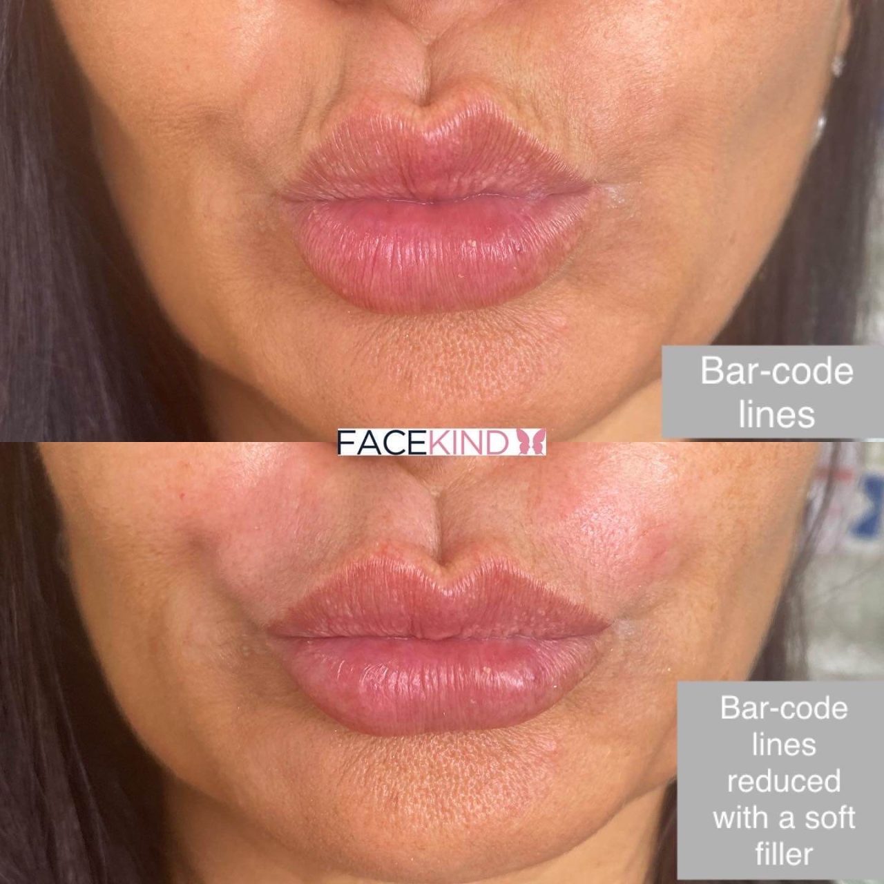 Gallery - DentalKind